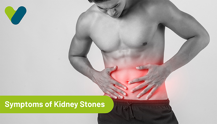 Kidney Stone Symptoms & Causes In Women & Men